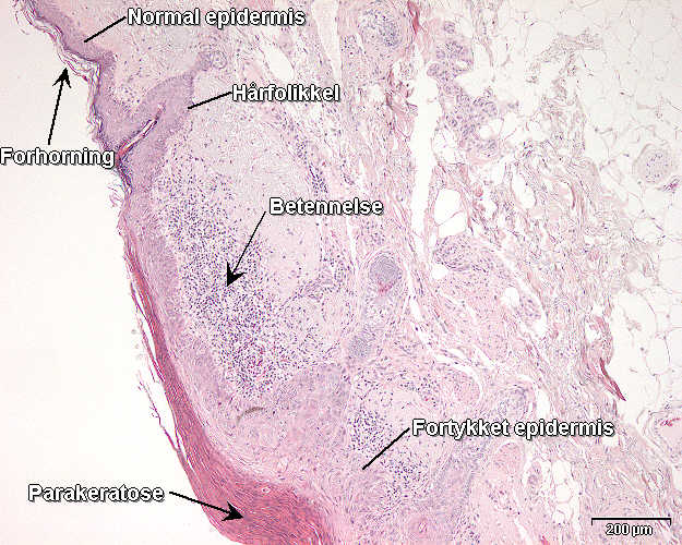 Histologi og patologi på nett - Det Medisinske Fakultet, UiO