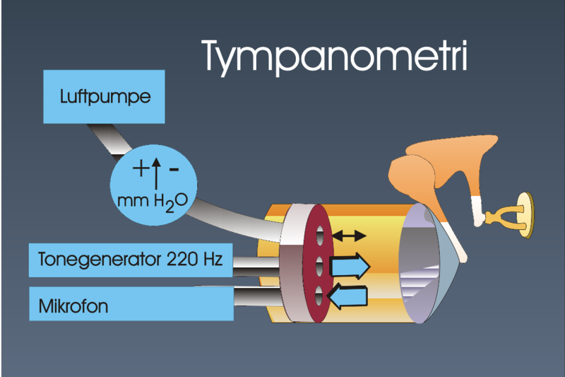 Fil:20141107105901!800px-Tympanometri skjema.svg.png – JournalWiki