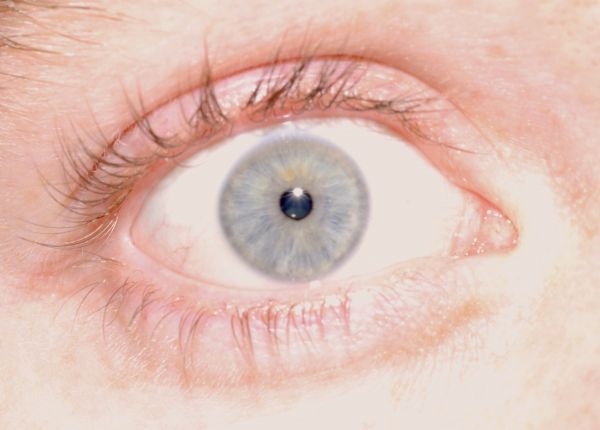 Miose – JournalWiki