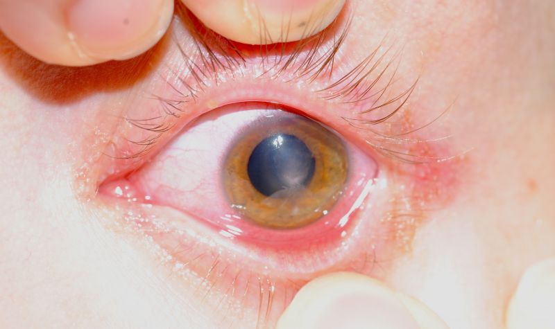 Keratitt – JournalWiki