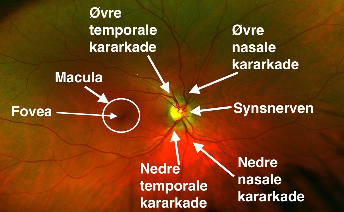 Papillen og retina – JournalWiki