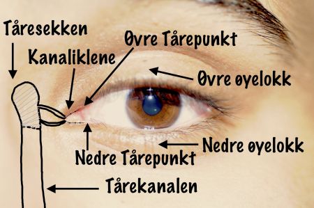 Øyeundersøkelse – JournalWiki