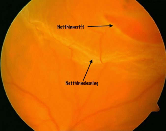 Netthinneløsning – JournalWiki