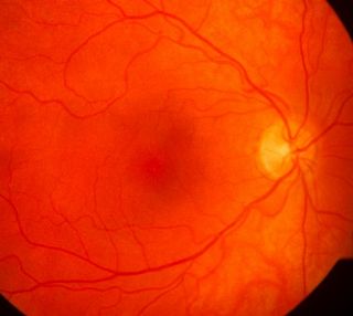 Øyeundersøkelse – JournalWiki