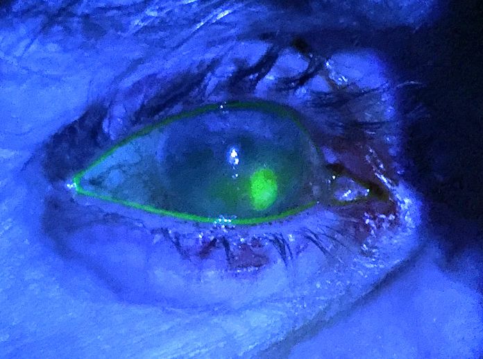 Keratitt – JournalWiki