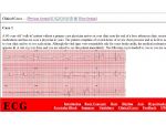 EKG – JournalWiki