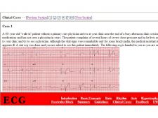 EKG – JournalWiki