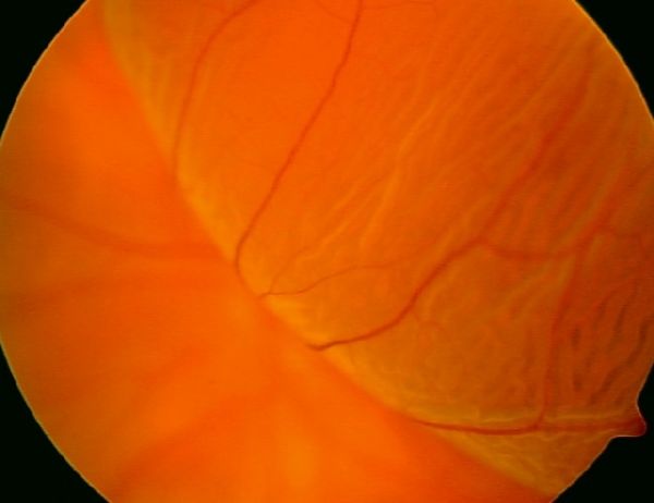 Netthinneløsning – JournalWiki